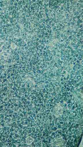 Pus Under Microscope: Exploring Zit Popping and Bacteria