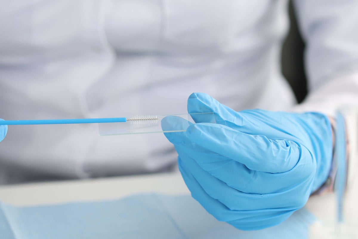 NHS to roll out DIY cervical cancer testing kits