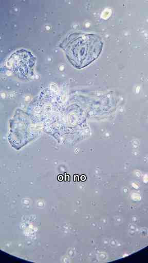 Exploring Bacteria on Toothbrush Under a Microscope