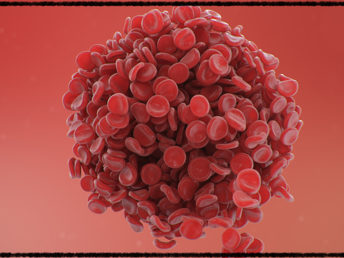 9 subtle signs of a brain blood clot that can appear weeks before a stroke