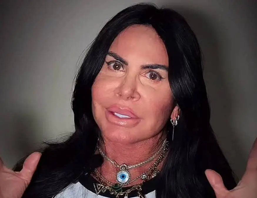 Gretchen revela diagnóstico de doenças após desistir de reality da Record