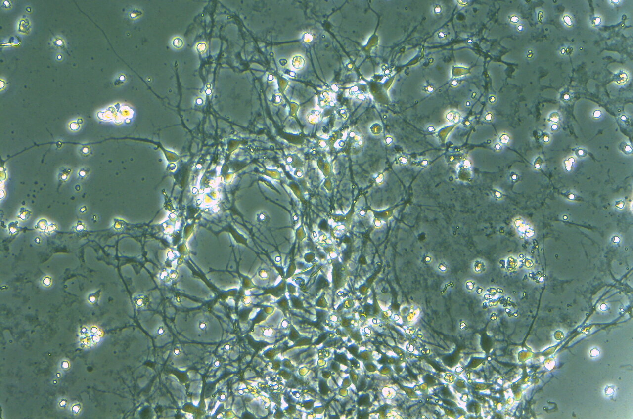 Mouse stem cell lines offer new window into autism's genetic associations