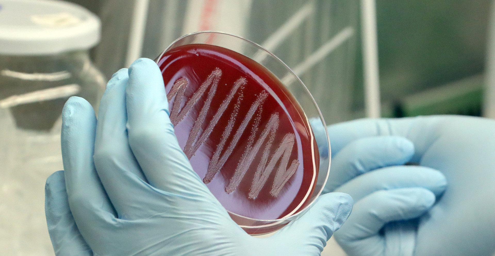 The harmful bacteria that can exist in the human body