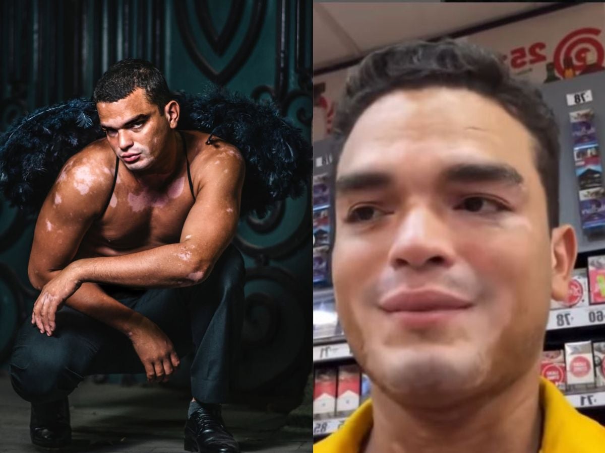 ¿Qué le pasó a Daniel Ruenes? De ser un modelo reconocido a sobrevivir ...