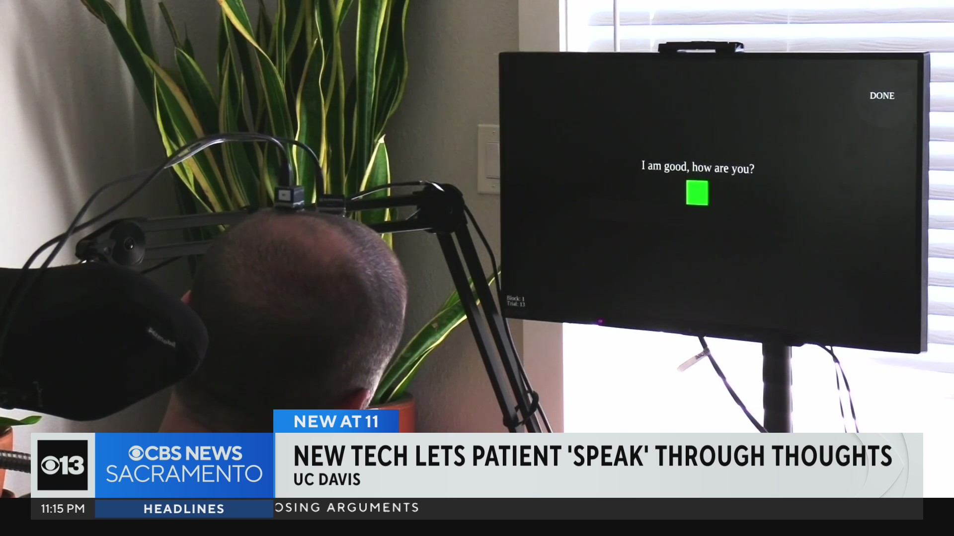 New UC Davis tech lets ALS patient speak through thoughts