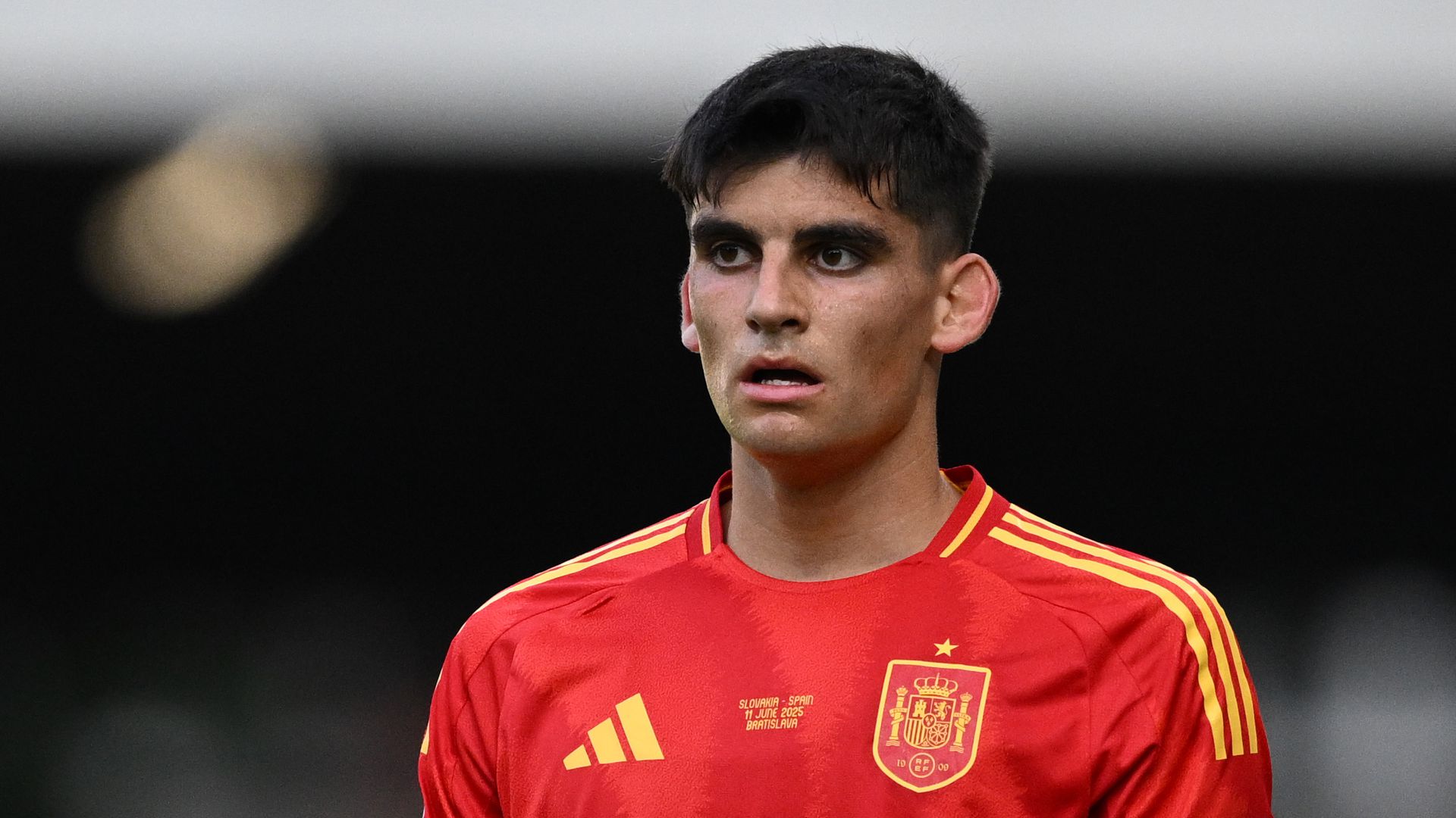 Martin out of Spain U21 squad and set for ‘immediate surgery’ on hand ...