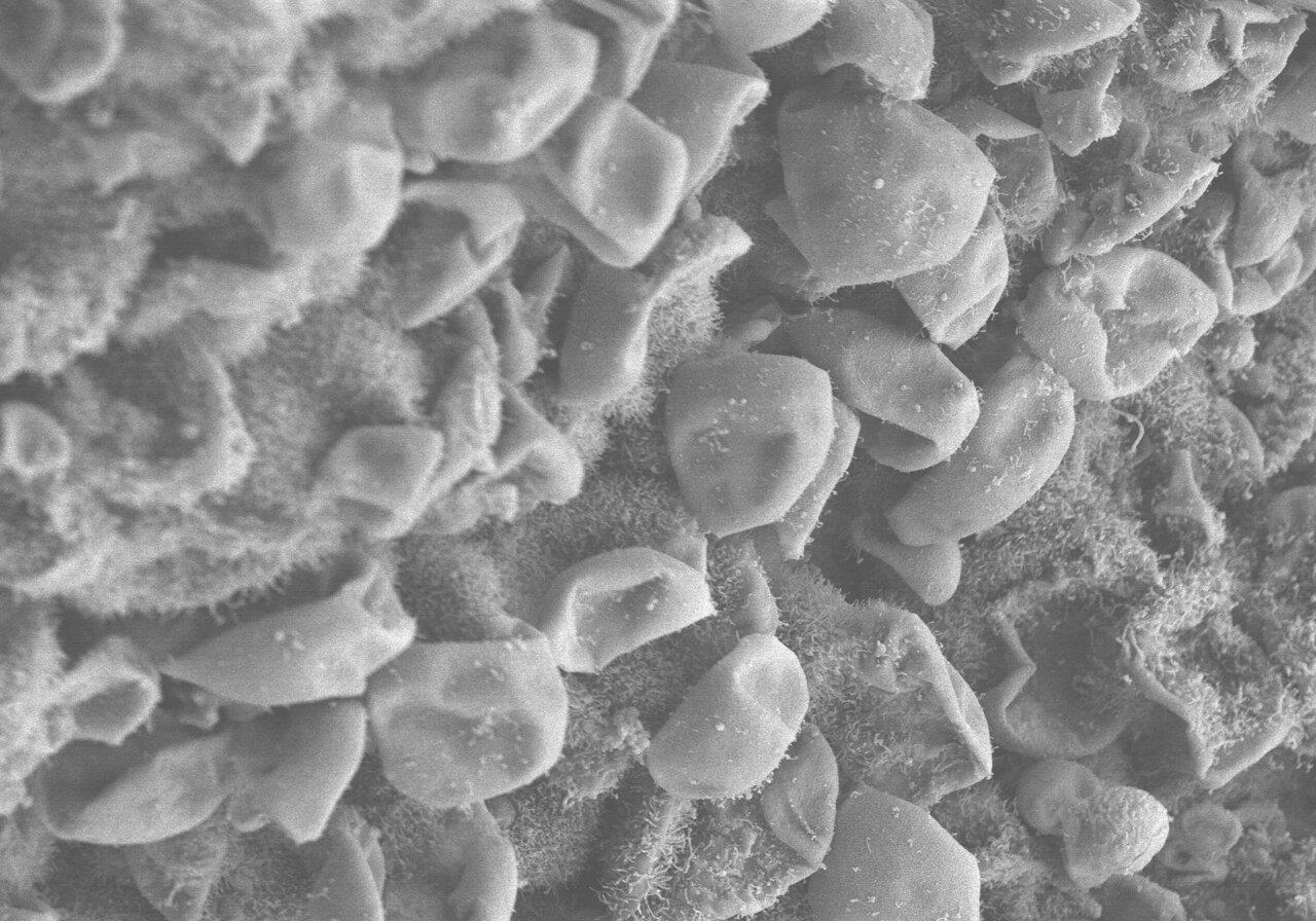 How choroid plexus apocrine secretion shapes fetal brain development