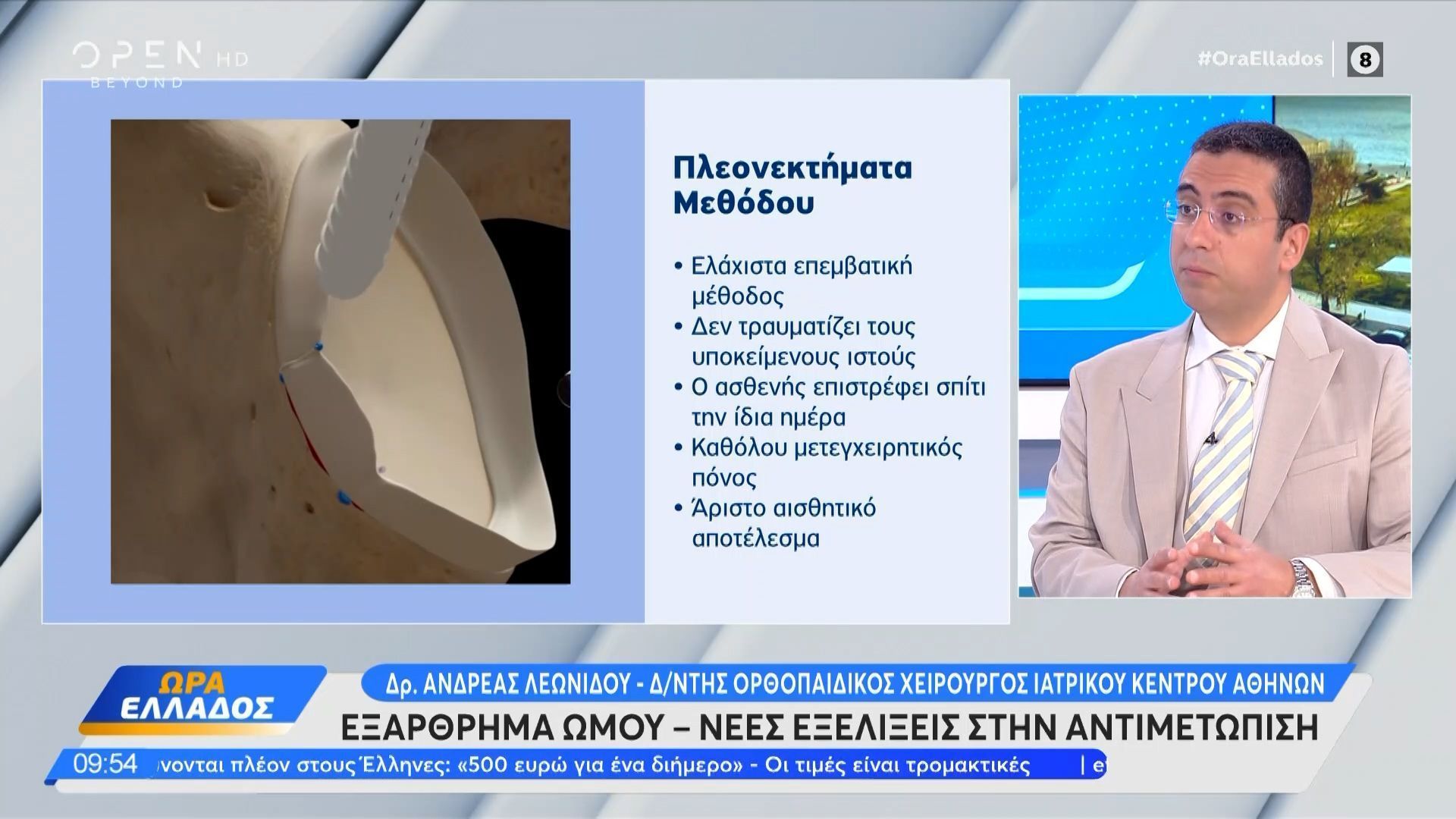 Εξάρθρημα ώμου - Νέες εξελίξεις στην αντιμετώπιση