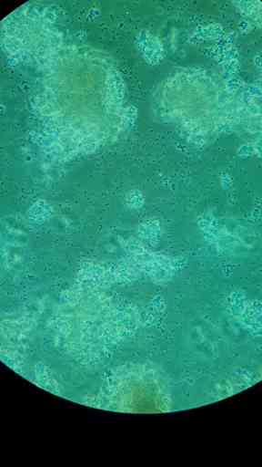 Exploring Yogurt Under the Microscope