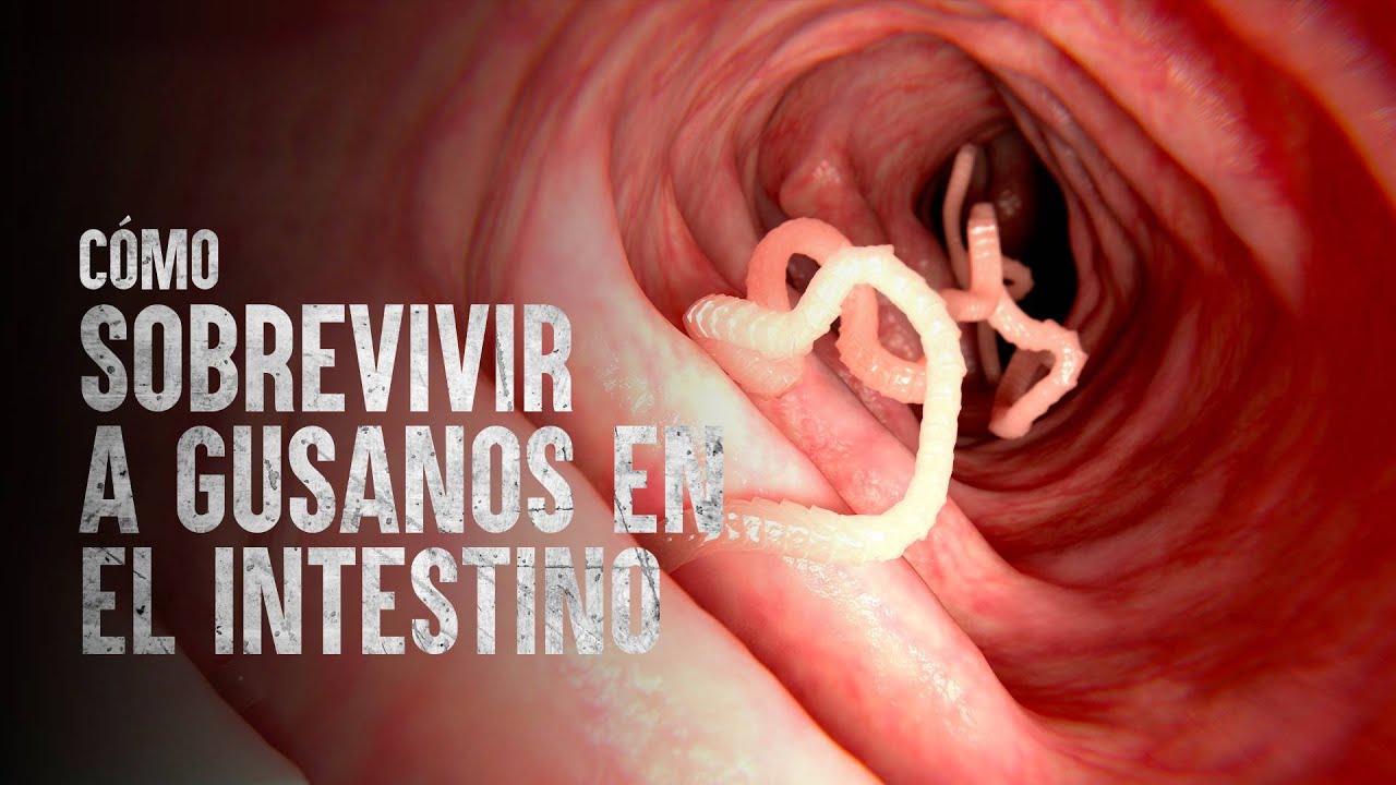 Cómo Sobrevivir con gusanos en el intestino