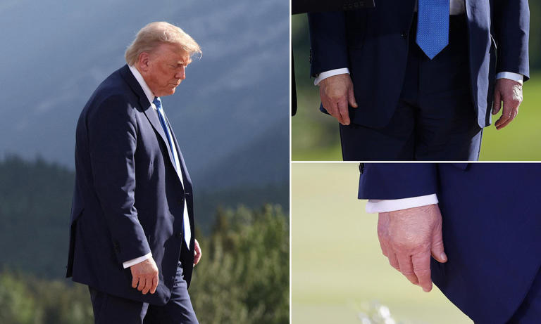 Trump sparks concerns over his health in images from G7 Summit