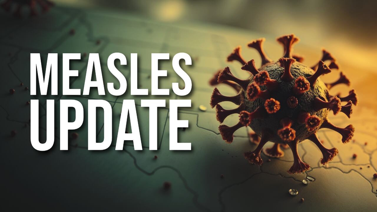 Measles cases rise to 79 in total in Kansas