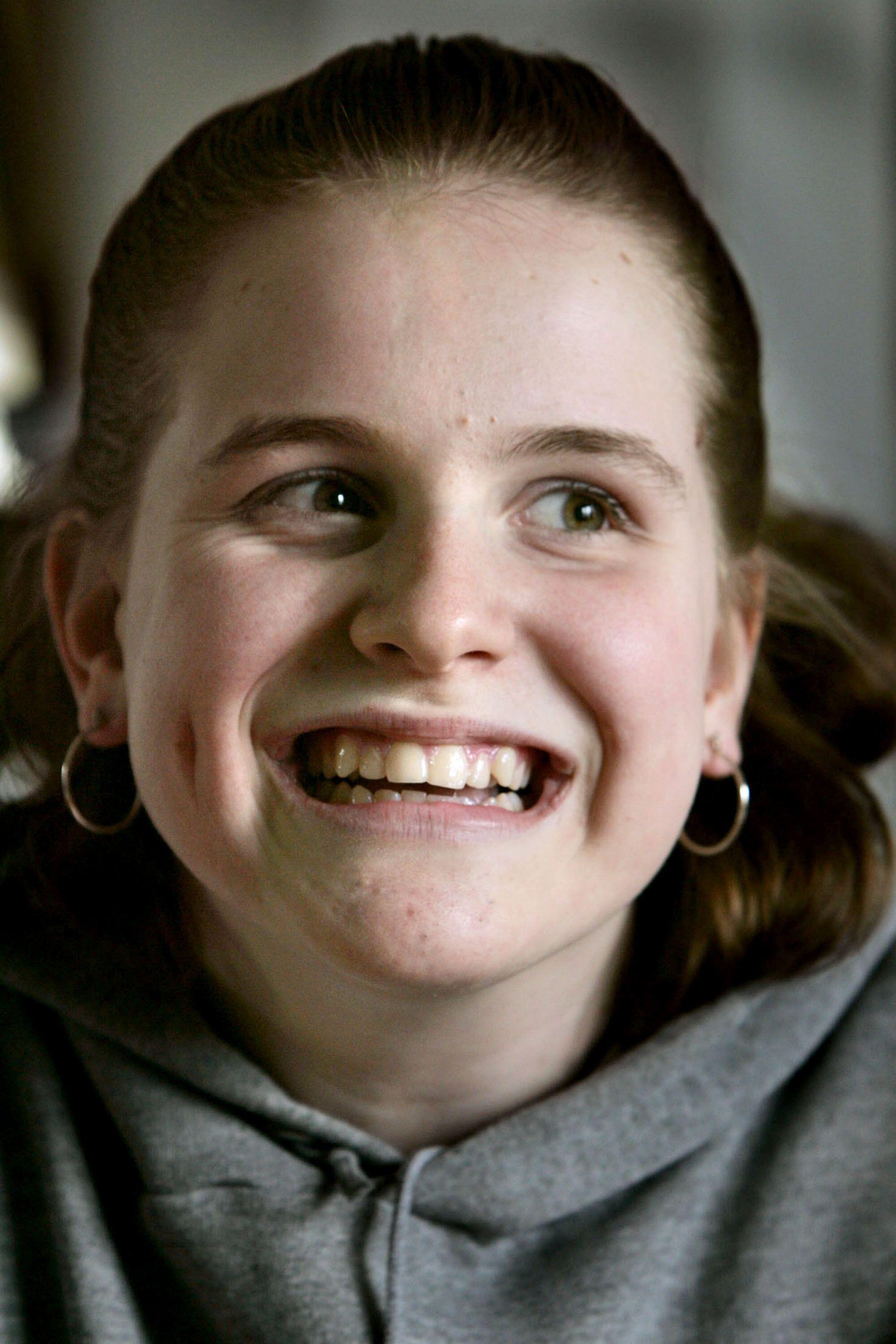 The first person to survive rabies without vaccination