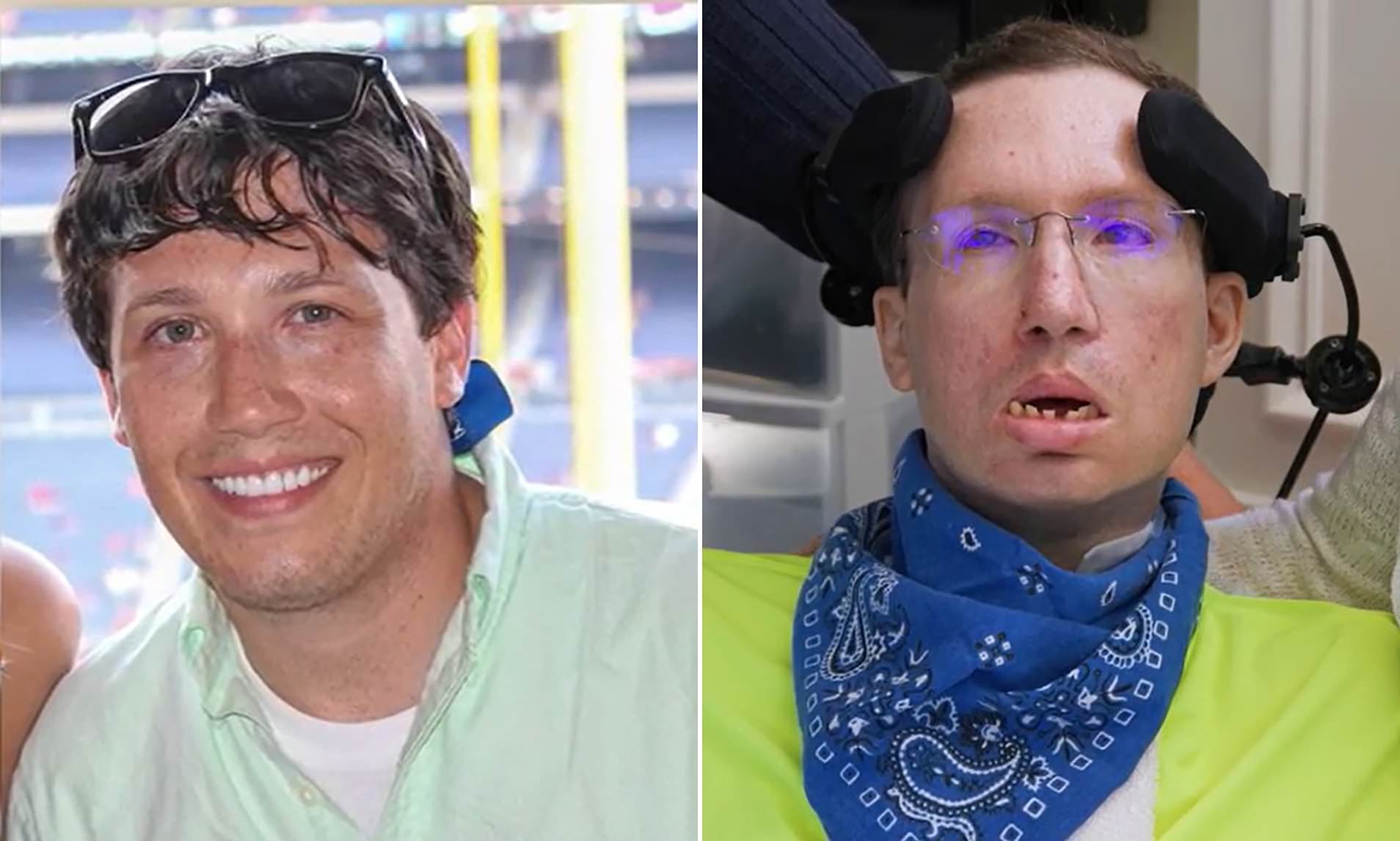 Man in his 20s went for simple neck adjustment at chiropractor and ...