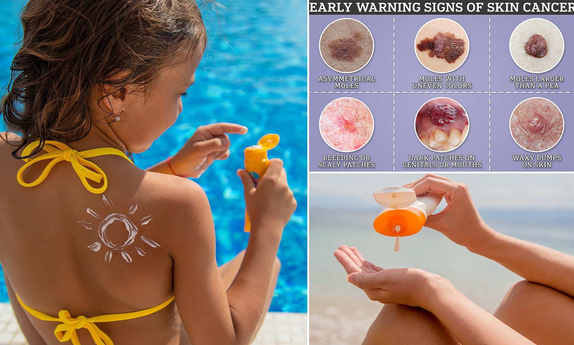 Major skin cancer warning slapped on popular sunscreen: 'It doesn't do ...