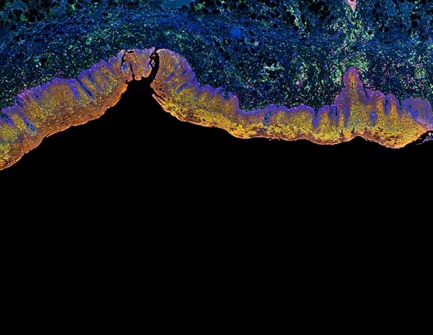 New 3D immunohistochemistry method enhances deep tissue imaging