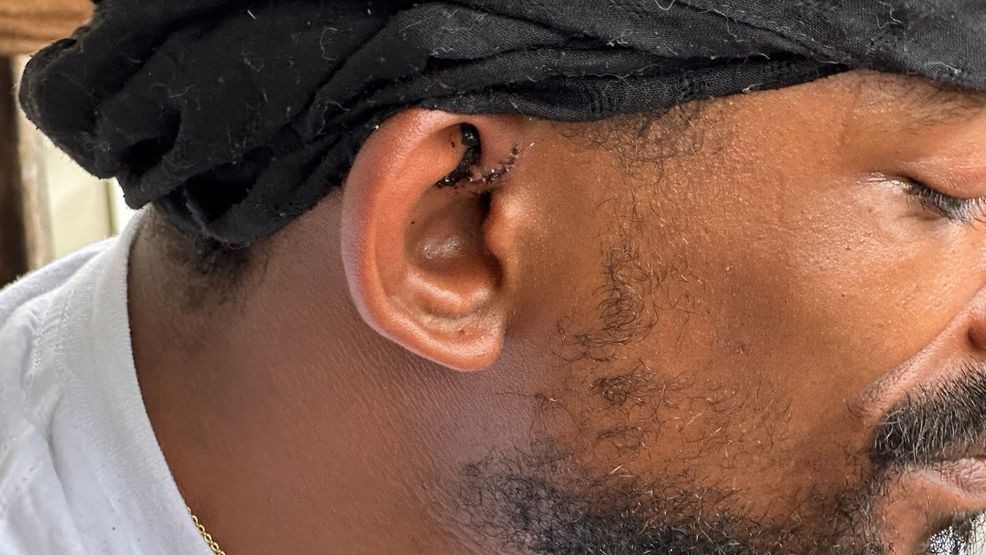 ABC13 Exclusive: Man struck by bullets on Pierce Street shares story
