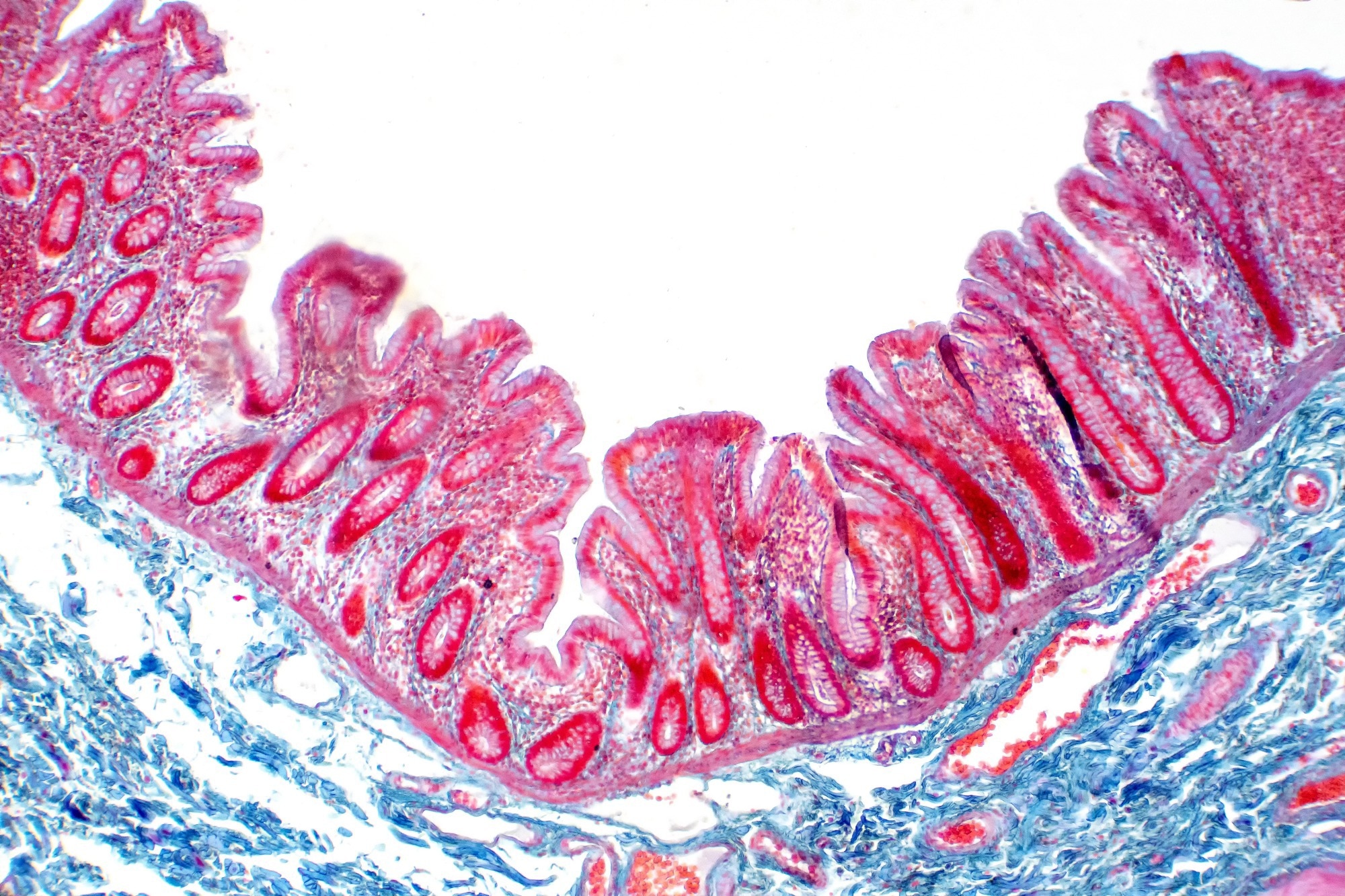 Organotypic Model of the Human Gut Epithelium Demonstrates Genetic ...