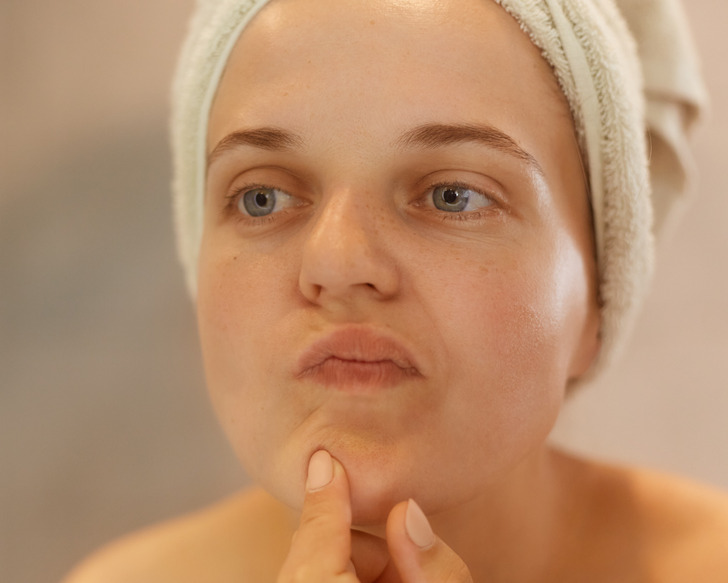 7 Skin Bumps That Aren’t Acne You Might Be Overlooking