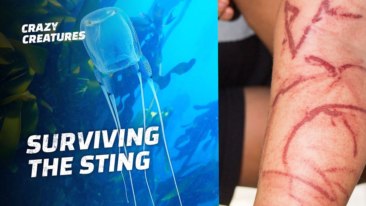One Sting, Minutes to Live – The Deadly Box Jellyfish!