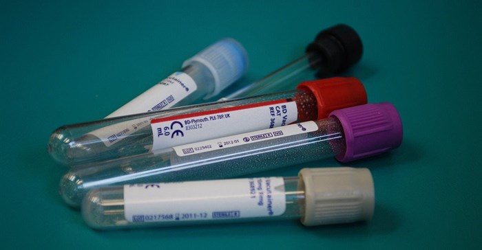 Codix Bio to produce HIV, malaria test kits amid USAid cutbacks