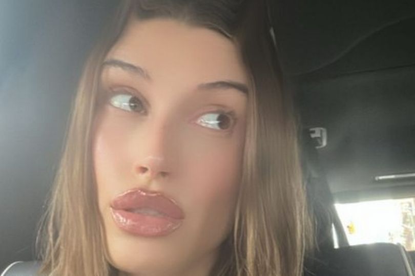 Hailey Bieber Divorce Rumours Are Rampant After She Was Spotted Without