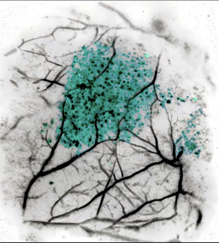 Microplastics beneath skin to toxic lakes: Wellcome Photography Prize ...