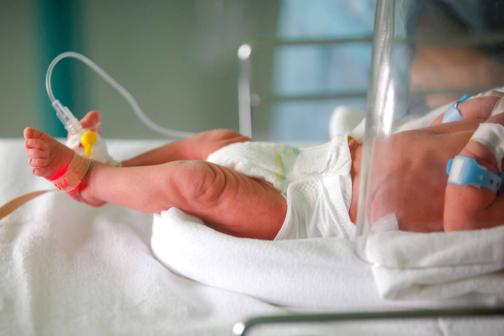 Toddler Who Spent 9 Months in Intensive Care Unit After Weighing Less ...