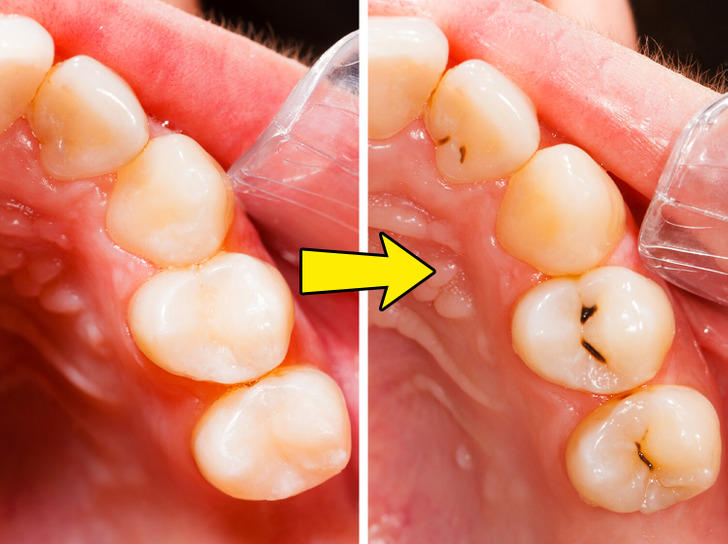 6 Early Signs of Dementia That Might Seem Completely Normal at First