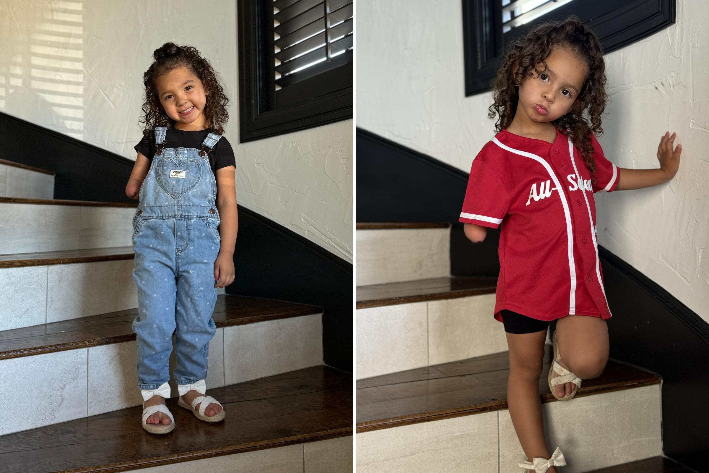 4-year-old gets new "robot arm"—Mom in tears over her response