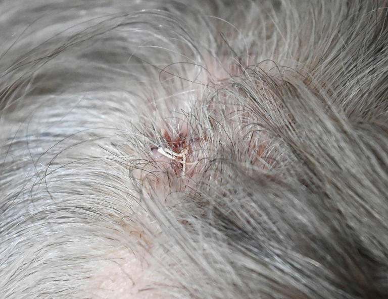 94-year-old NYC woman bludgeoned in random Oculus attack: ‘Wish I was a ...