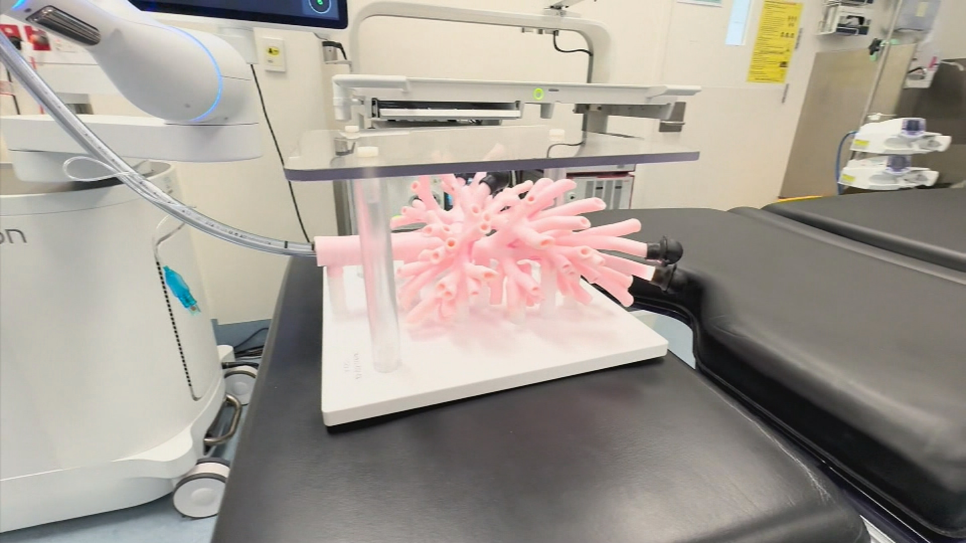 Groundbreaking machine could hold key to early lung cancer detection