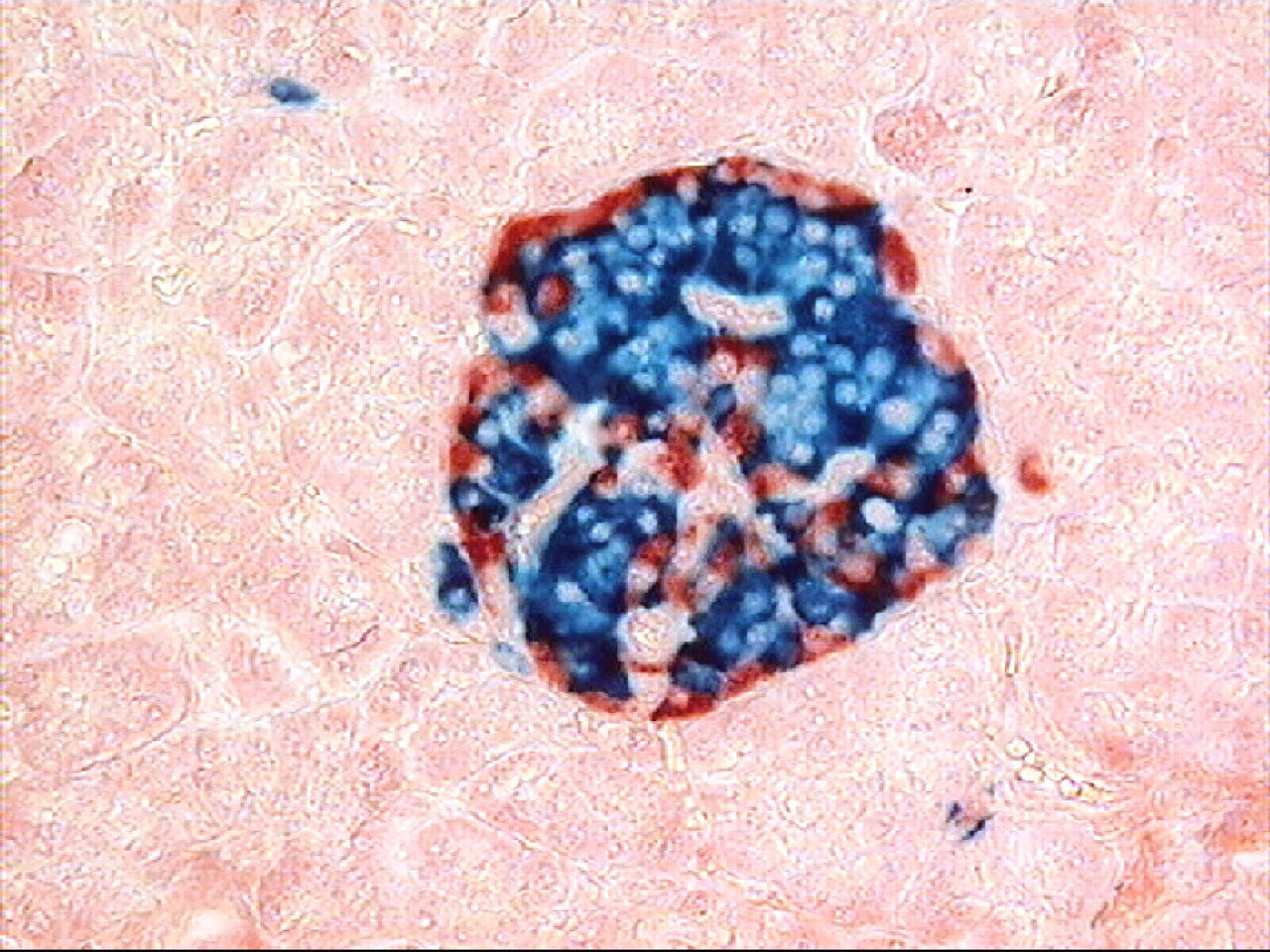 Scientists create functional 3D-printed human islets for type 1 ...