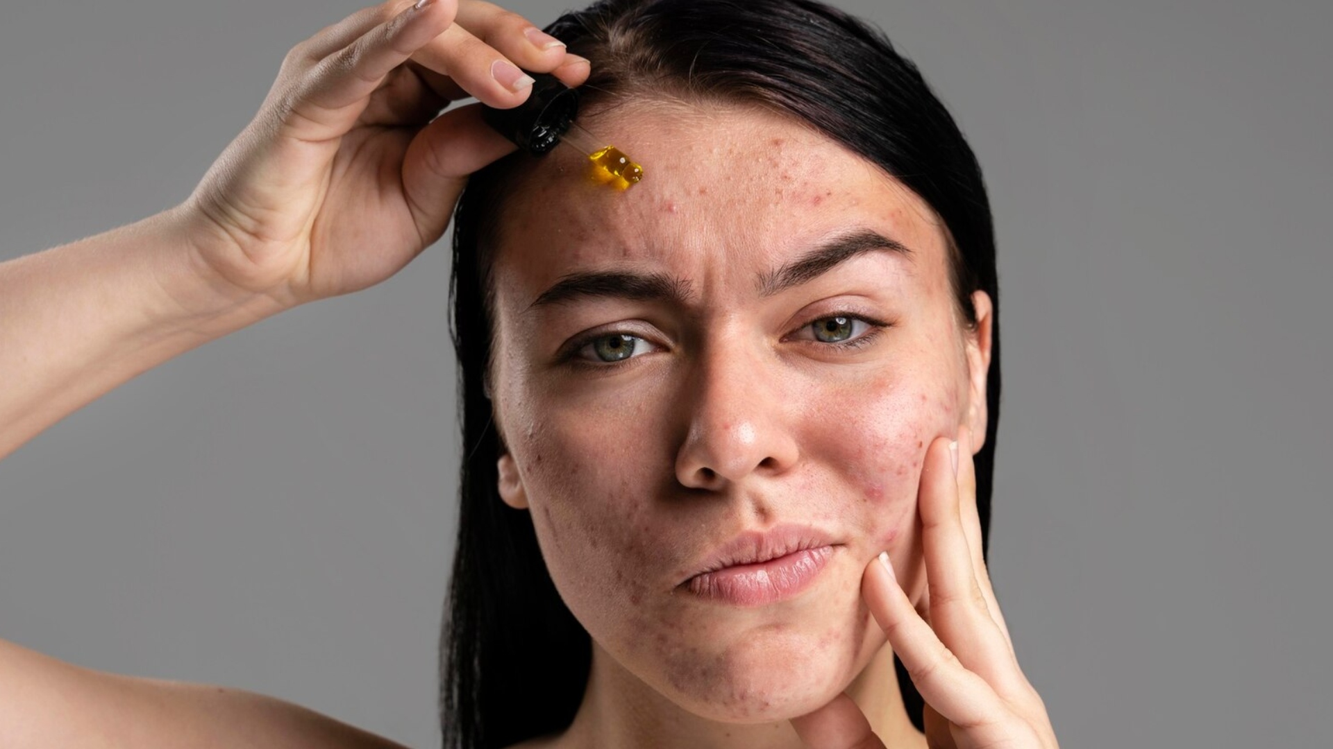 This simple gesture could be the real cause of your persistent pimples.