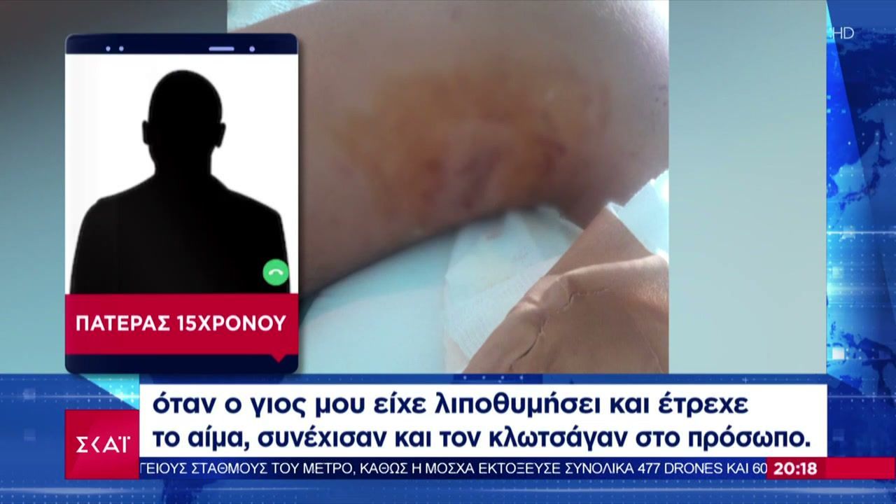 Άγρια επίθεση σε λεωφορείο στην Πετρούπολη: 16χρονος τραυμάτισε με ...