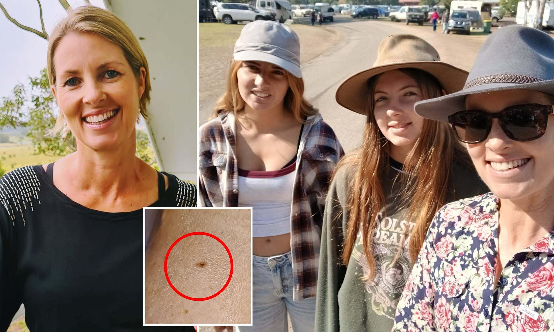 The doctor told me the unusual freckle on my back was 'nothing to worry ...