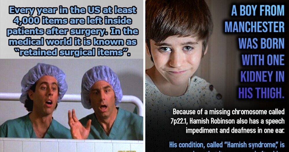 30 Wild and Strange Medical Oddities We Almost Didn't Believe