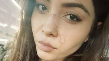 Former QVC Model Finds Strength in Woodchopping After Career-Altering ...