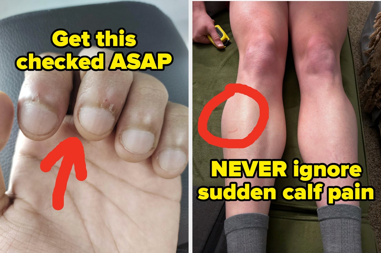 Doctors And Nurses Are Revealing The "Small" Health Signs You Should ...