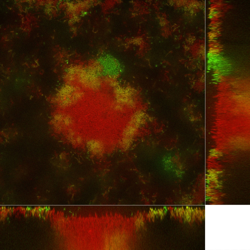 Antibiotic resistance: the biofilm paradox