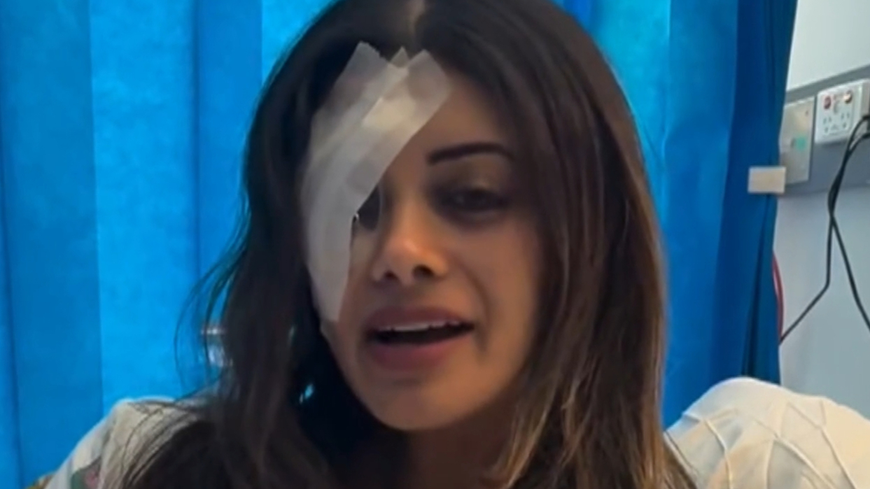 NSW Police drop anti-riot charge against injured protester Hannah Thomas