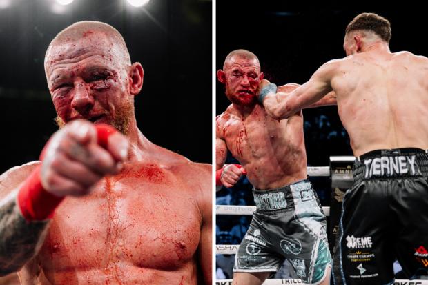 Carlisle man's title fight pics show brutal nature of bare-knuckle boxing