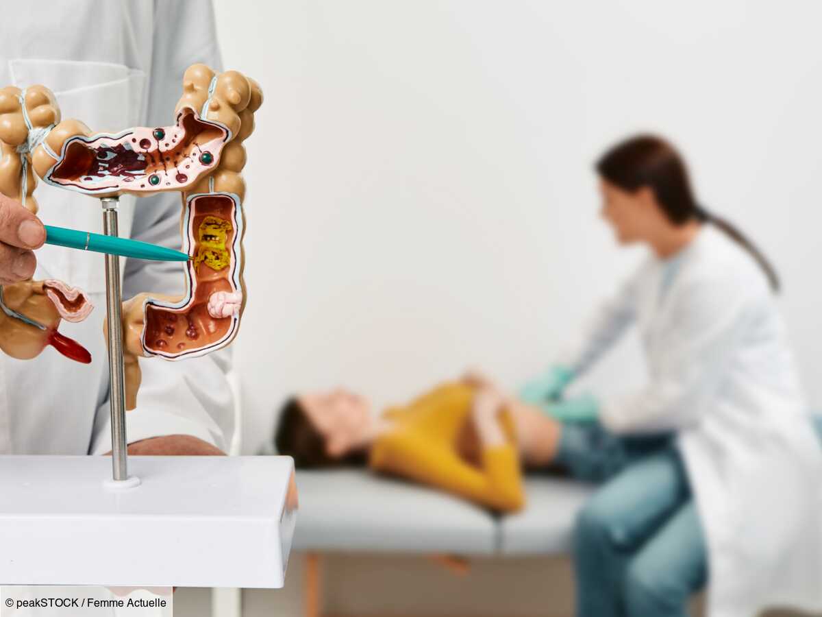 Infarctus digestif : voici comment reconnaître les symptômes de cet ...