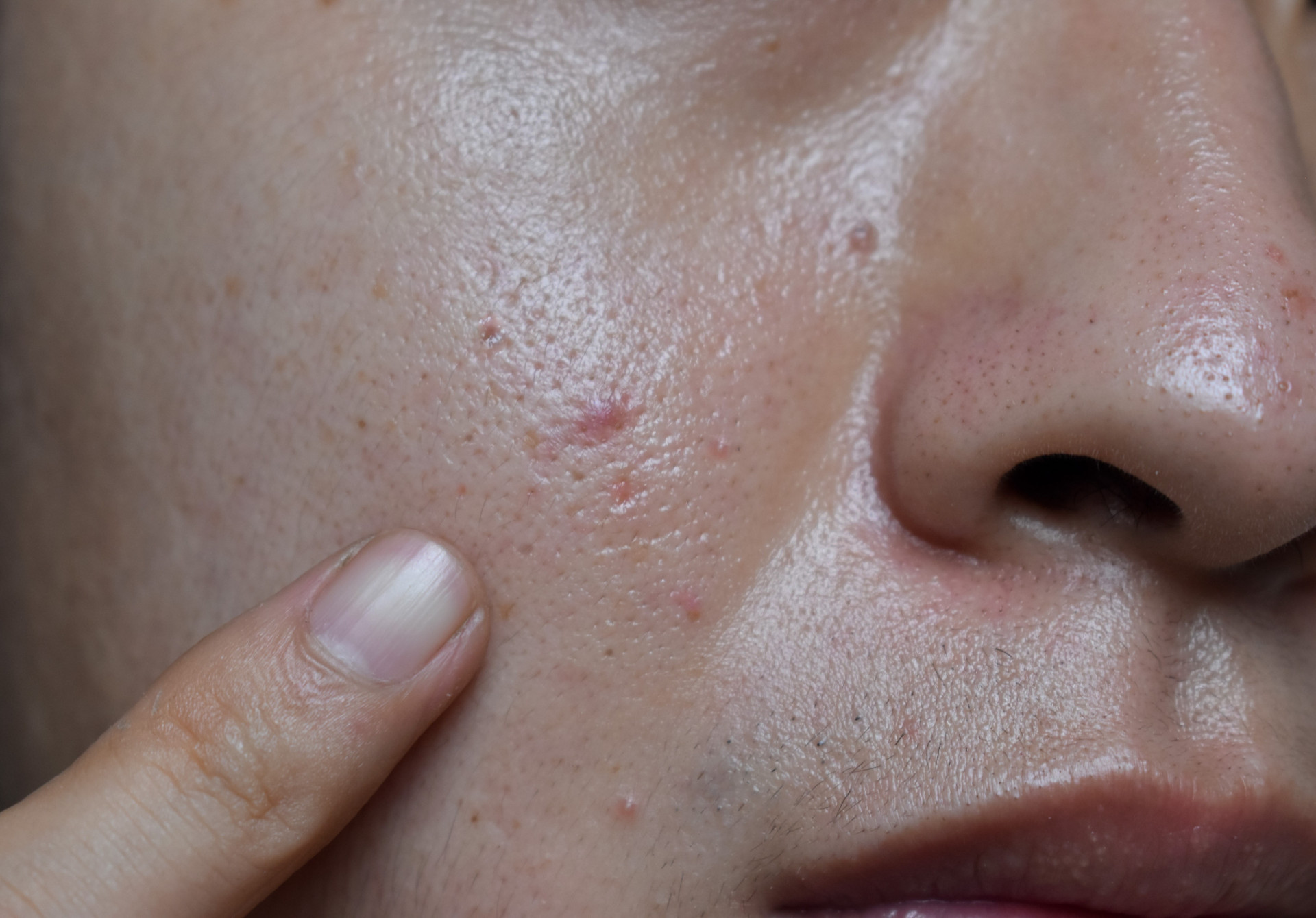How to deep clean your body