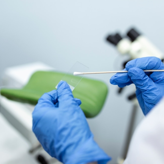 Cervical cancer prevention: 7 steps every woman should follow