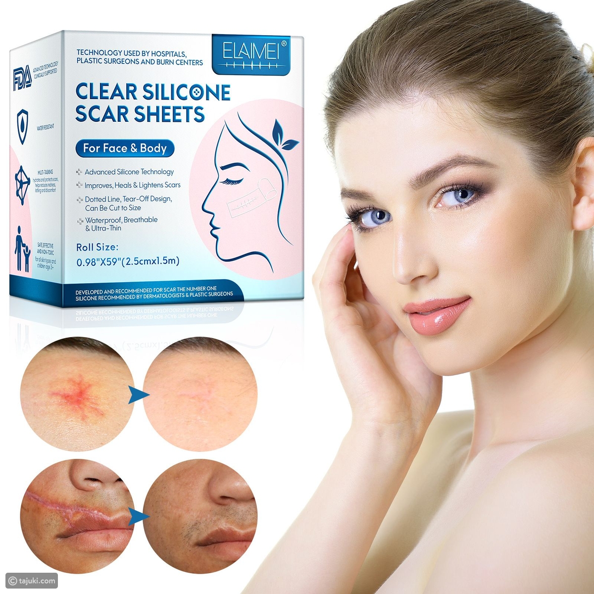 وداعاً للندوب، اكتشفي القوة الشفائية لشرائح السيليكون