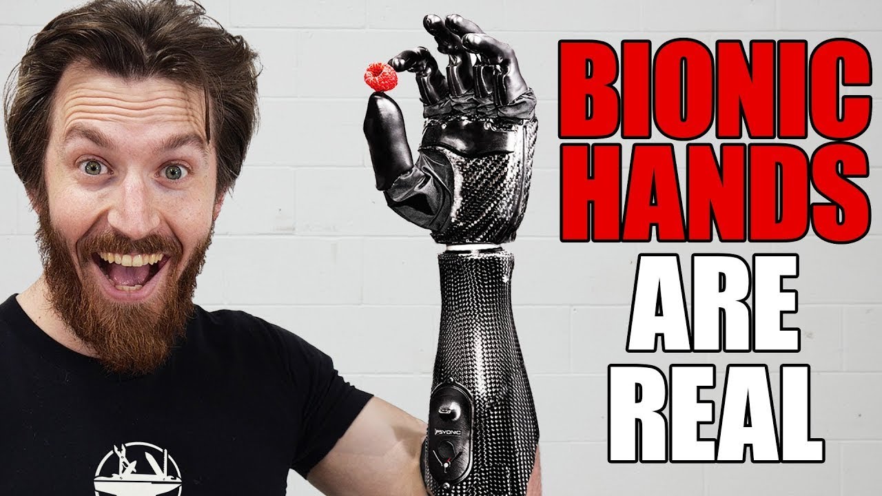 The Future of Prosthetics: This Bionic Hand Changes Everything