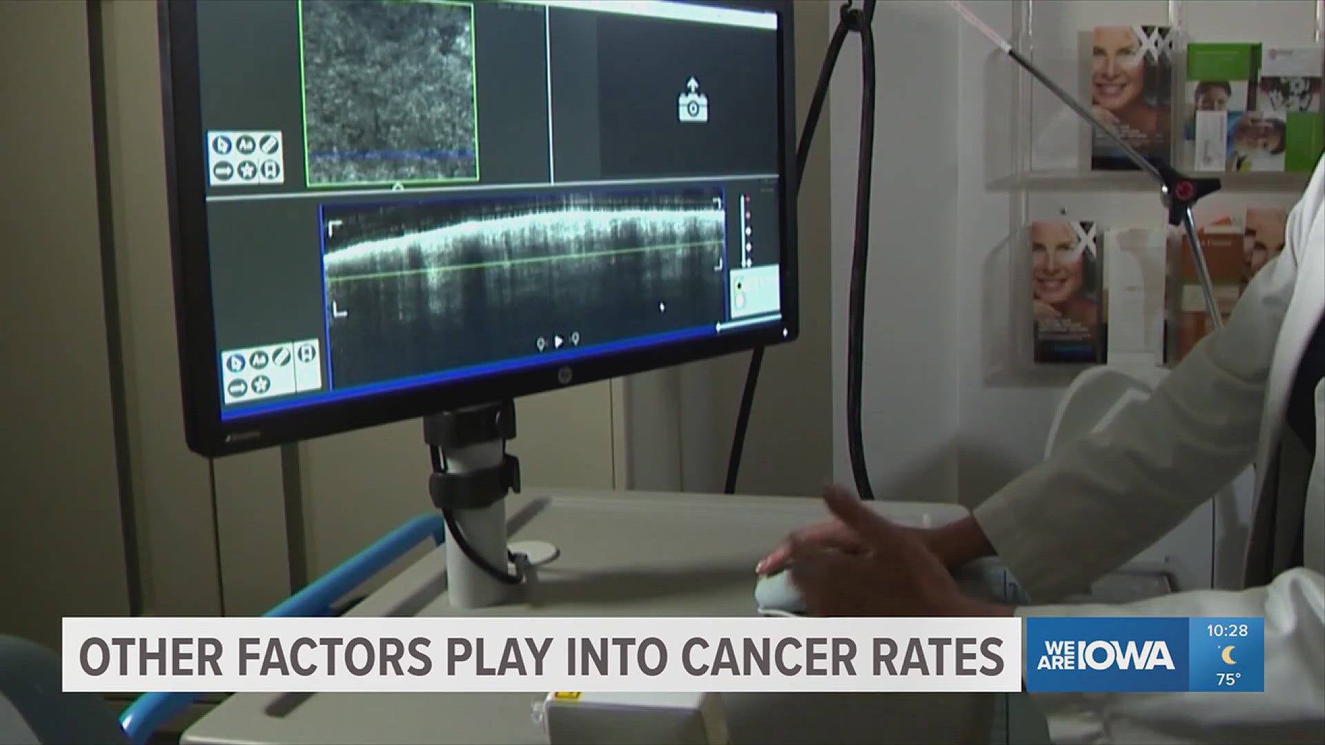 What's behind Iowa's high cancer rates?