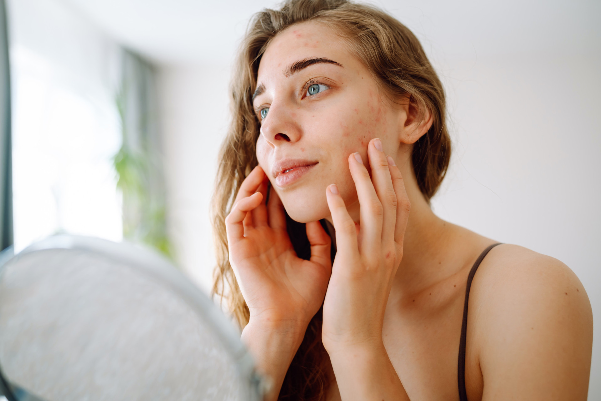 Sensitive skin: causes, care, and when to seek help