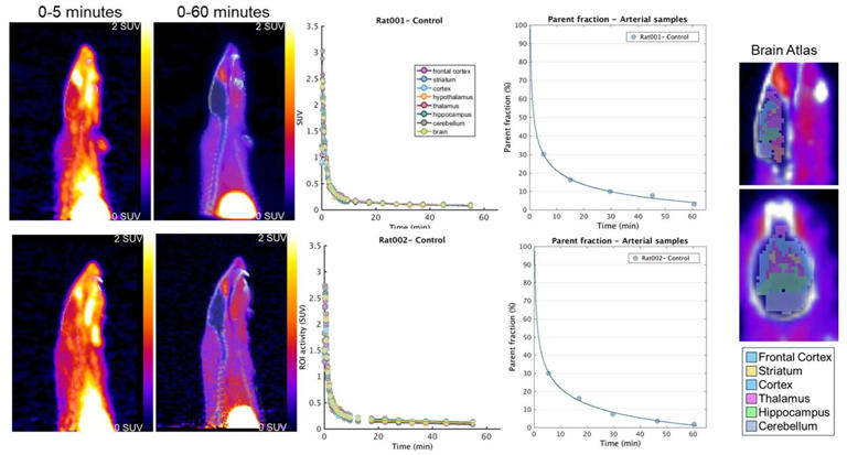 Click chemistry PET imaging tracks antisense drug distribution in the brain